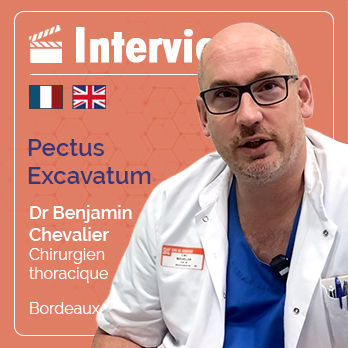 Interview du Dr Chevalier (chirurgien thoracique) à propos du Pectus ...